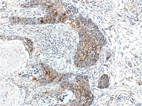 RPN Antibody AP Proteintech