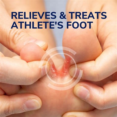 Athletes Foot Treatment 4 In 1 Gel Dr Scholls™ Uk