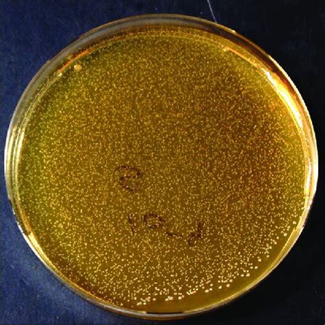 Plaque Of Phage On Double Layered Agar Download Scientific Diagram