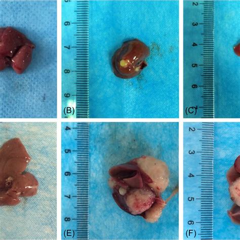 General Condition Of Liver In Mice Infected With Echinococcus Download Scientific Diagram