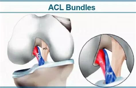 Double Bundle Acl Reconstruction Tied To Better Ikdc Objective Grading