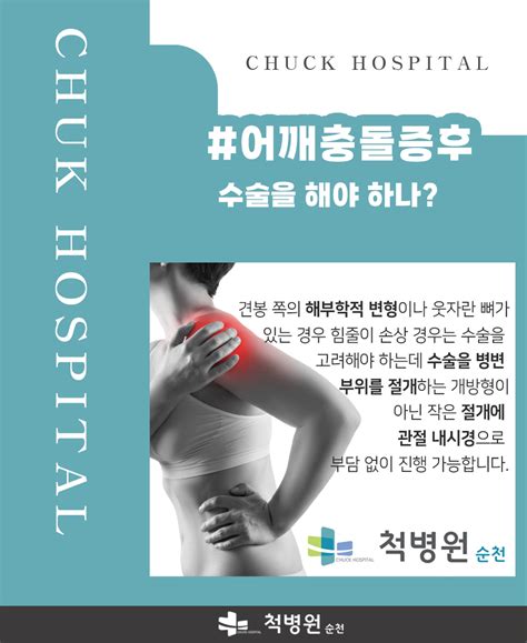 통증 어깨통증 어깨충돌증후군 그 치료 방법과 증상은 소셜채널
