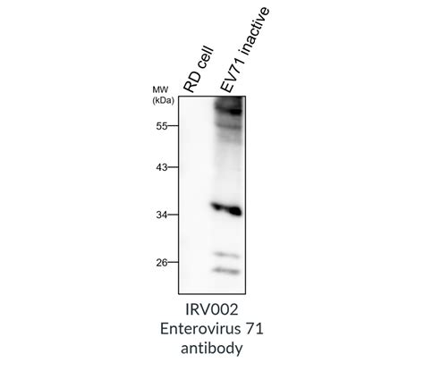 Enterovirus 71 Ev71 Antibody Irv002 Ireal Biotechnology Inc