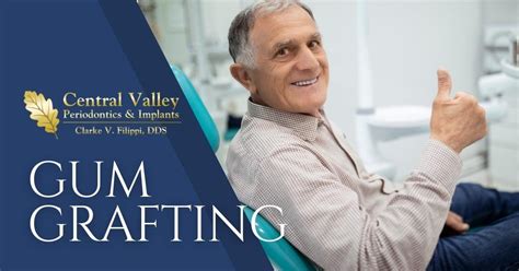Gum Grafting — Modesto Ca — Clarke V Filippi Dds