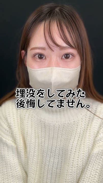 埋没してみた。まつ毛の生え際が見えてぱっちり二重に！ 美容整形 湘南美容クリニック名古屋院 二重整形 埋没法 Youtube