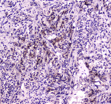 Npc2 Antibody Pa5 79755