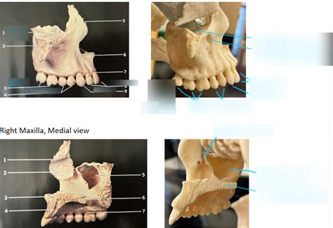 Right Maxilla Lateral And Medial Views Diagram Quizlet
