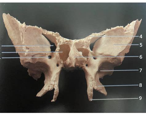 Sphenoid Bone Anterior View Quiz