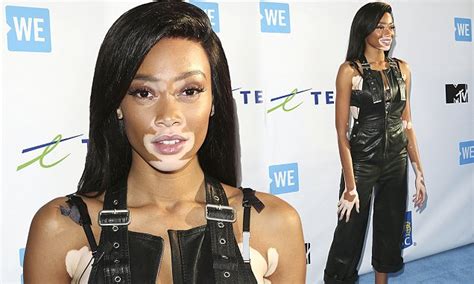 Winnie Harlow Stuns In Leather Dungarees And Lace Bralet At We Day
