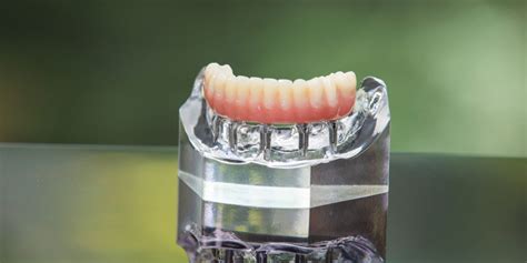 Understanding Dental Implants How And When You Can Get All Your Teeth