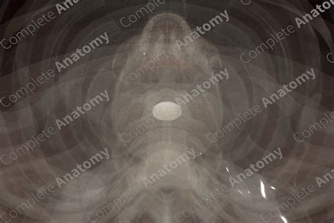 Intervertebral Disc C6 C7 Complete Anatomy