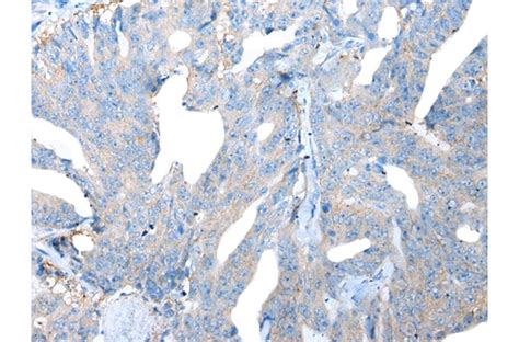 Anti Lamp1 Antibody A46505