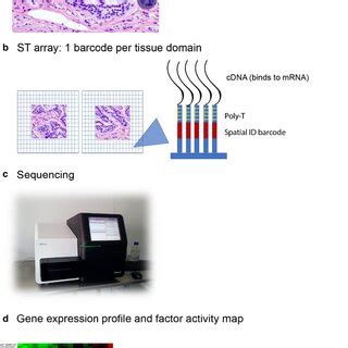 Spatial Transcriptomics Workflow Including The Downstream Analysis A