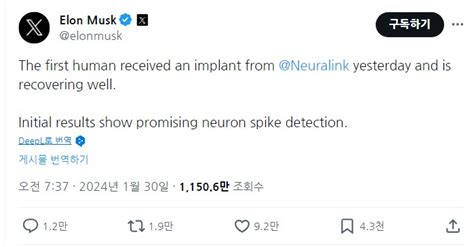 뇌 컴퓨터 연결 시대 오나머스크 인간 뇌에 칩 이식 성공
