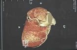 Image Color Is Changed When Print Nroduit Weasis Discussion Github