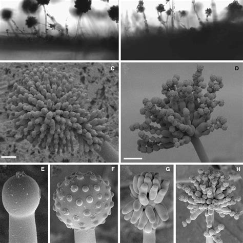 Radial Growth And Sporulation Profile Of 7 Day Old Xylose Grown