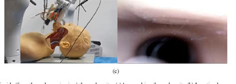 Figure 1 From Surgical Robotic System For Endotracheal Intubation Based