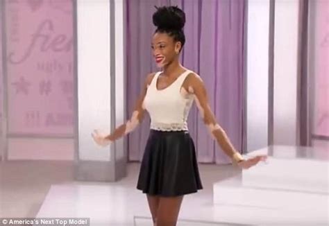 Winnie Harlow Claims Americas Next Top Model Did Nothing For Her