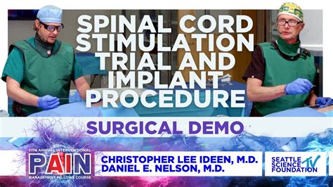 Spinal Cord Stimulation Trial And Implant Procedure Chris Ideen Md