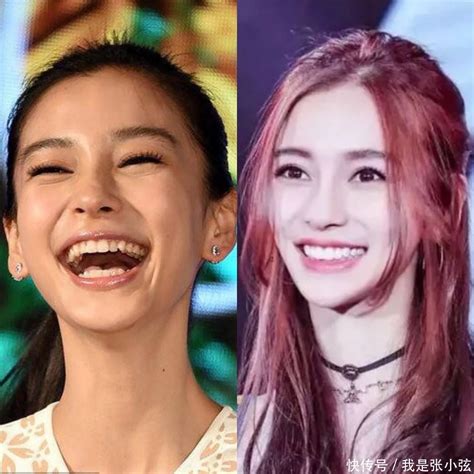 比牙黄更可怕的是牙龈外露一笑就破功很多明星都中招 6parkbbs