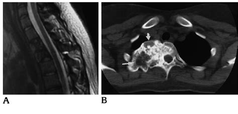 A Sagittal T2 Weighted Fast Spin Echo Mr Image 40001022 4 Years