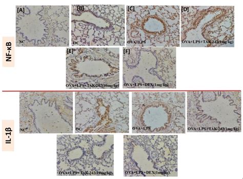 Immunohistochemical Analysis Of Nf κb And Il 1β Proteins In Mice Lung