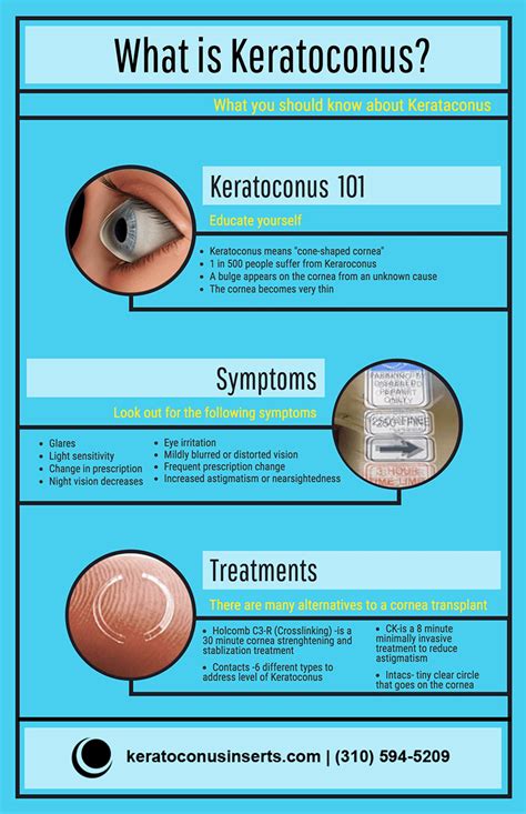 Cure For Keratoconus Keratoconus Infographic