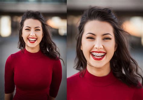 Free Braces Filter Online What Do I Look Like With AI Braces