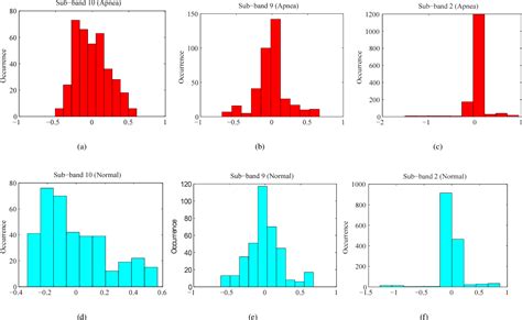 Figure 2 From Computerized Obstructive Sleep Apnea Diagnosis From