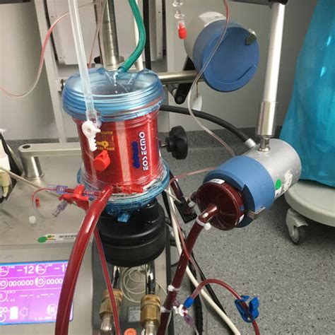 Frederik BONTE Perfusionist Clinical Perfusionist AZ Delta