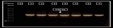 Detection Of Pseudomonas Aeruginosa 16s Rrna 530bp Gene By Pcr Lanes Download Scientific