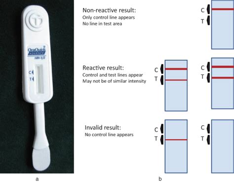 Conditions Of False Positive And False Negative Hiv Test