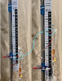 Critical Care Device Series External Ventricular Drain Emra