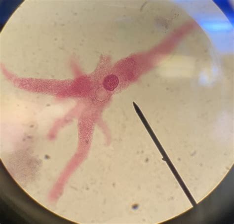 Phylum Identification Flashcards Quizlet