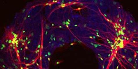 Image Of The Day Compact Brain The Scientist Magazine®