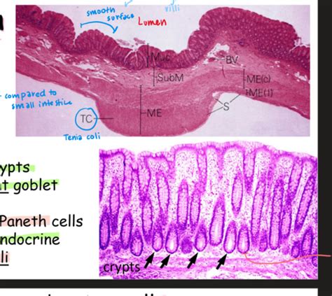 Taenia Coli Histology