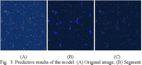 Figure 1 From Brain Cell Segmentation And Detection From The Livecell