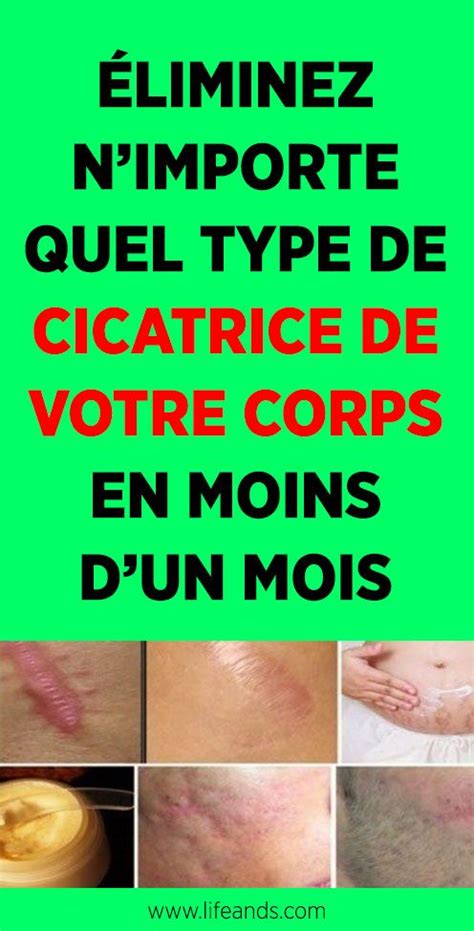 Élimine tout type de cicatrices dans le corps en moins dun mois Esprit Santé Cicatrice