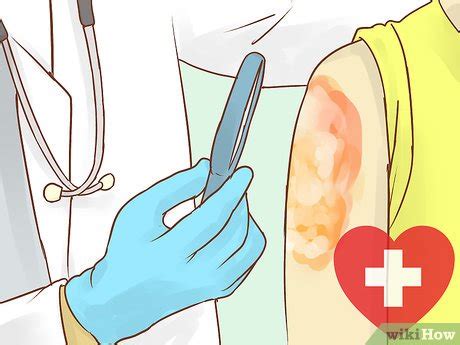 3 Ways To Prevent Dry Scalp WikiHow Health