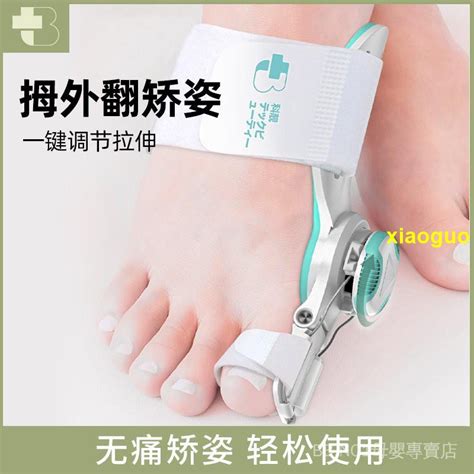 日本科靚拇指外翻腳趾矯正器可調節旋鈕大腳骨母腳糾正分趾器男女【剪刀】 蝦皮購物
