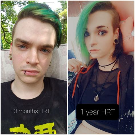 1 Year Hrt Today Rtranstimelines