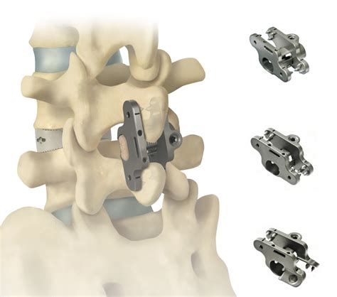Product Detail Neurospine