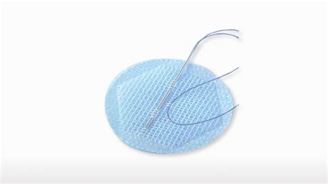 Hernia Mesh And Fixation Devices