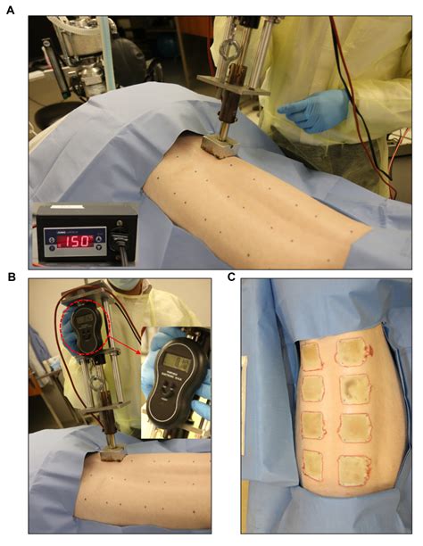 Swine Model Of Biofilm Infection And Invisible Wounds