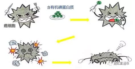 日本医疗利用胶体碘疗法怎么治疗癌症的 霓虹医疗直通车
