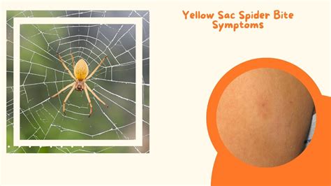 17 Types Of Spider Bite Symptoms Id With Pictures