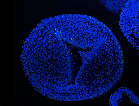 Nano Plastics Disrupt The Growth Of The Heart Eyes And Nervous System