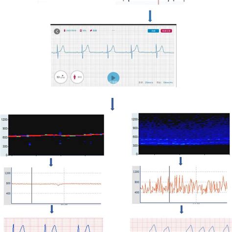 Work Flow Of Portable Long Time Single Lead Ecg Monitor And Ecglab Download Scientific Diagram