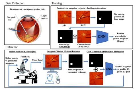 Robotic Eye Surgery Autonomous Systems Control And Optimization