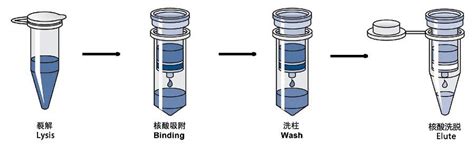 Dna提取试剂盒有哪些种类？各种类产品的优缺点又是什么？检测
